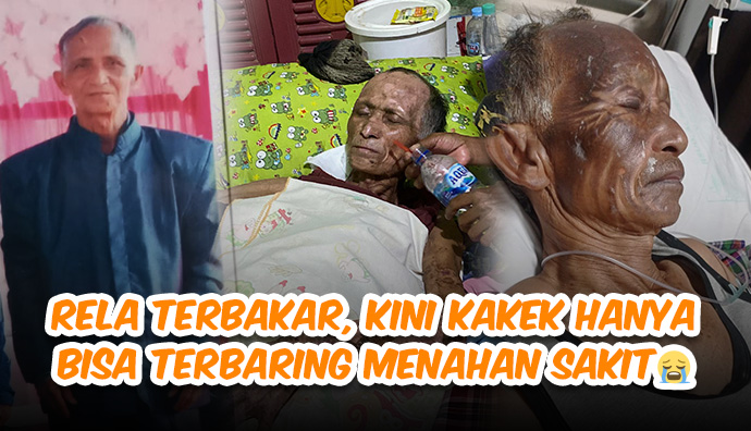 Tubuh Alami Luka Bakar, Bantu Lansia Ini Sembuh - Donasi Online