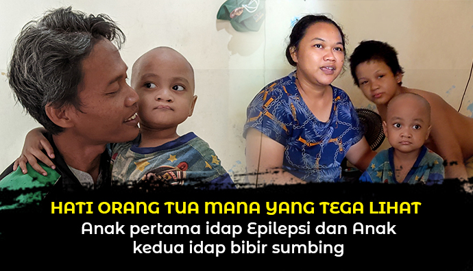 Bantu Pengobatan Anak Ojol Idap Bibir Sumbing - Donasi Online